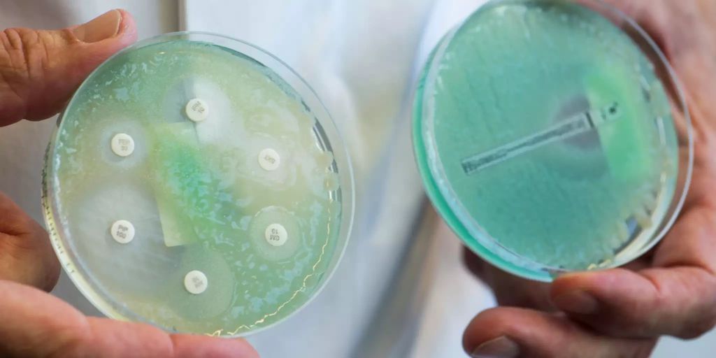 Antibiotikum: Neuer Ansatz gegen die Resistenz-Krise