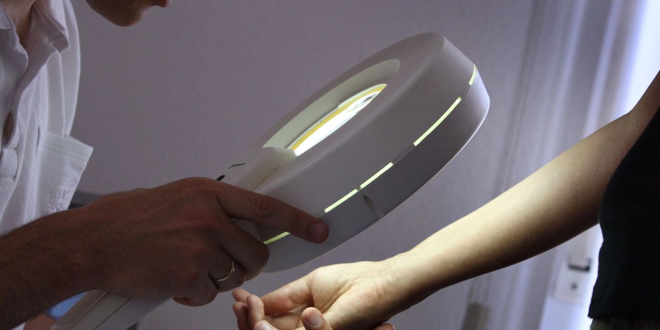 Was steckt hinter der Hautkrankheit Morbus Grover? | Nau Health