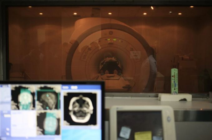 MRI von Britin zeigt, dass Face-Filler 20 Jahre im Gesicht bleiben | Nau.ch