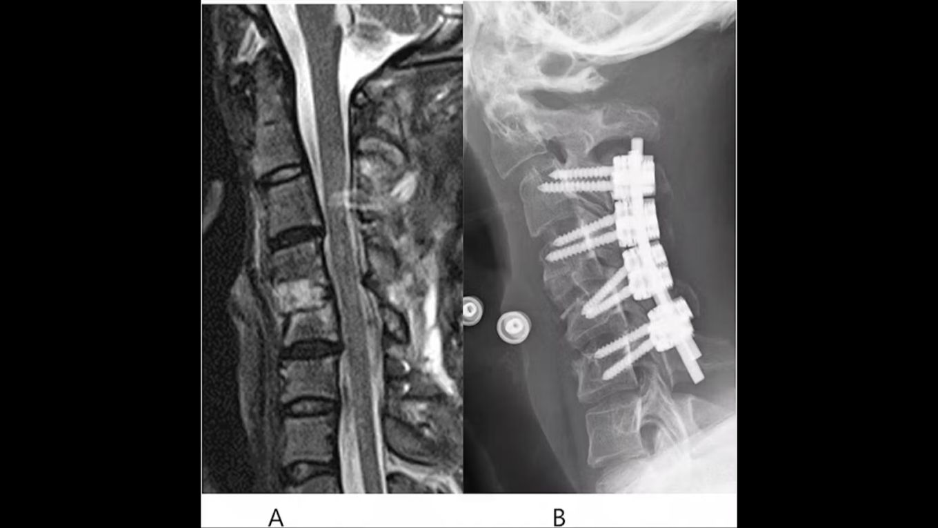 Dropped-Head-Syndrom durch Handy: Gamer kann Kopf nicht mehr heben | Nau.ch