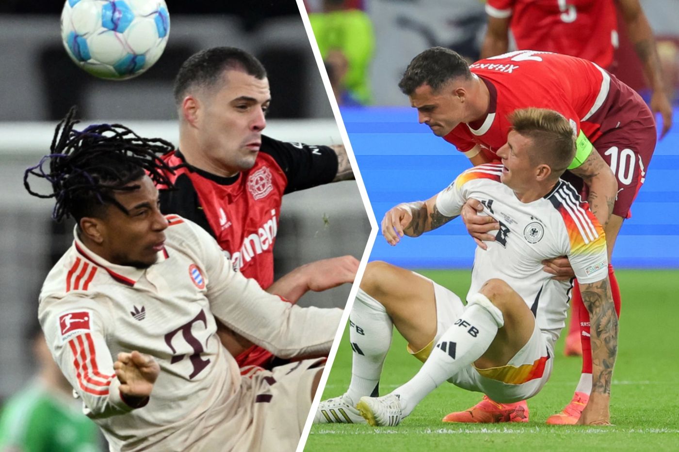 Darum verliert Granit Xhaka nach Transplantation jetzt seine Haare | Nau.ch