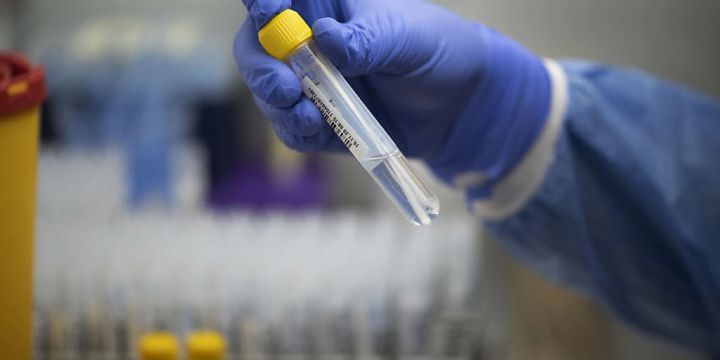 Roche hat mit vielen Unsicherheiten zu kämpfen | Nau.ch