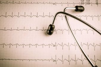 Vorhofflimmern vs. Vorhofflattern – die Unterschiede | Nau Health