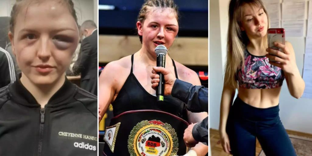 Aua! Diese Boxerin erkennt sich im Spiegel wohl kaum wieder