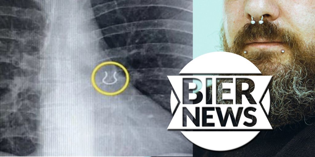 Röntgenbild enthüllt: Das Piercing steckt in der Lunge