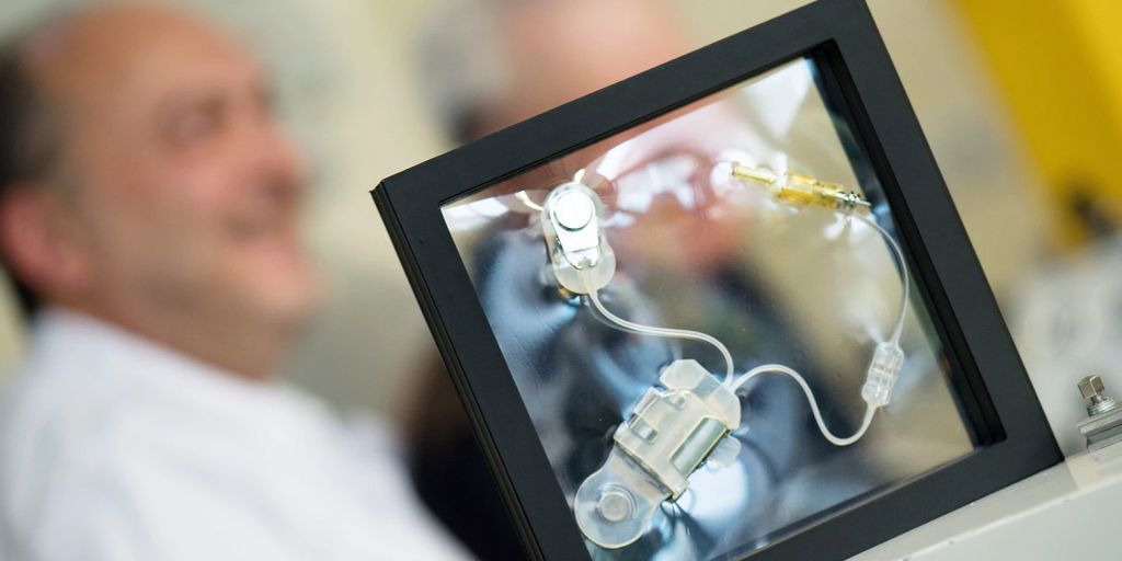 Hörhilfe: So funktioniert ein Cochlea-Implantat