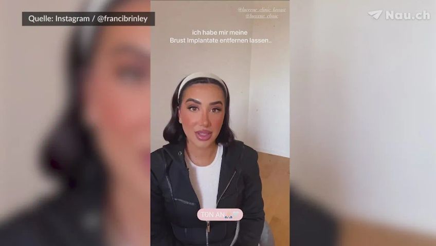 «Bachelor»-Franci lässt sich Brust-Implantate entfernen
