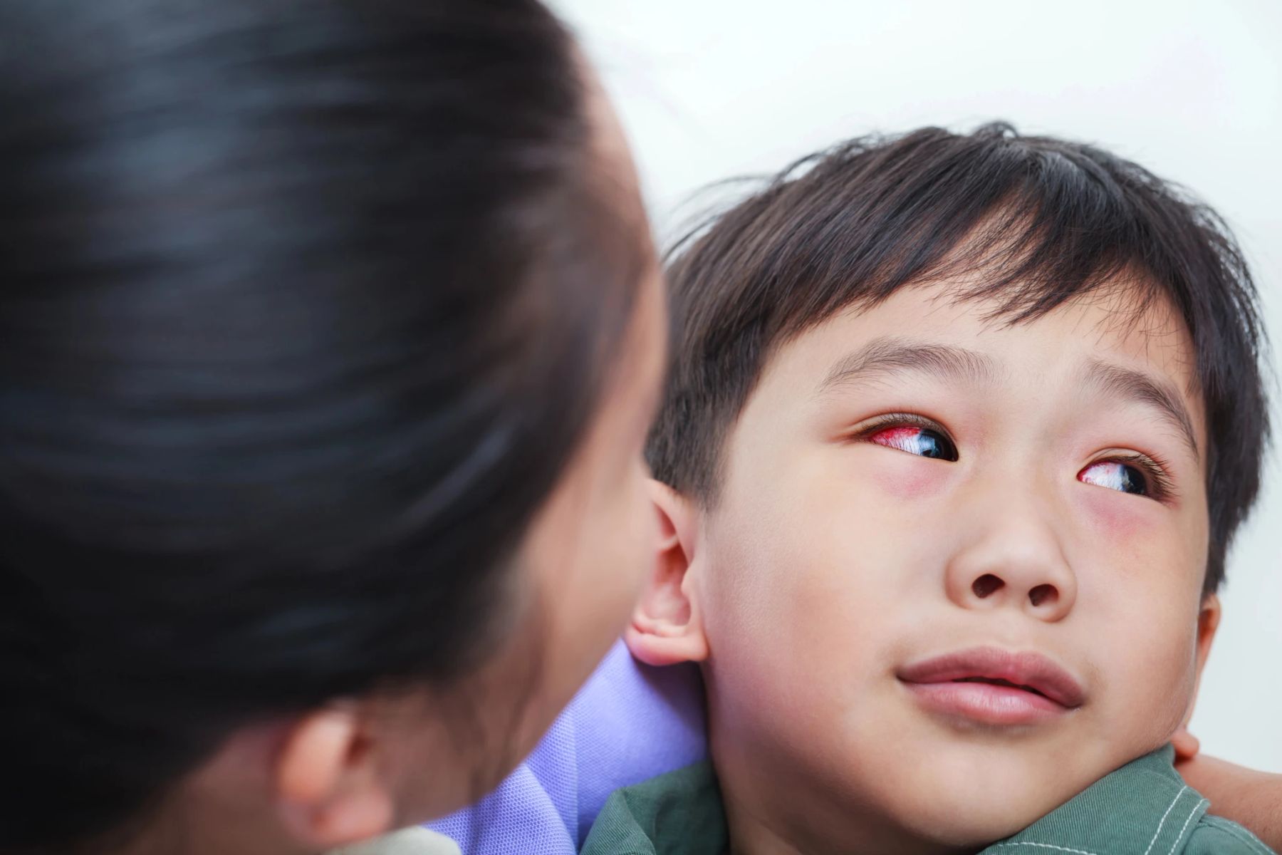 Alarmstufe Pink: Bindehautenzündungen bei Kindern | Nau Health