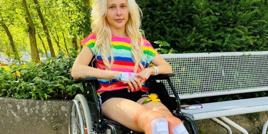 Nach Beinverlängerung: «GNTM»-Theresia wieder unterm Messer