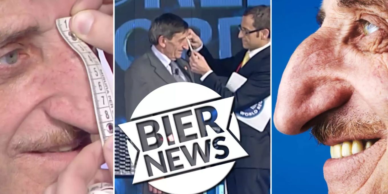 Dieser Türke hat die grösste Nase der Welt! | Nau.ch