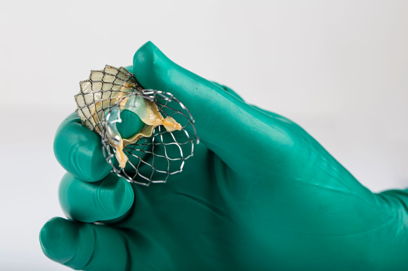 Erste erfolgreiche Implantation: Mitwachsende Herzklappenprothese | Nau.ch