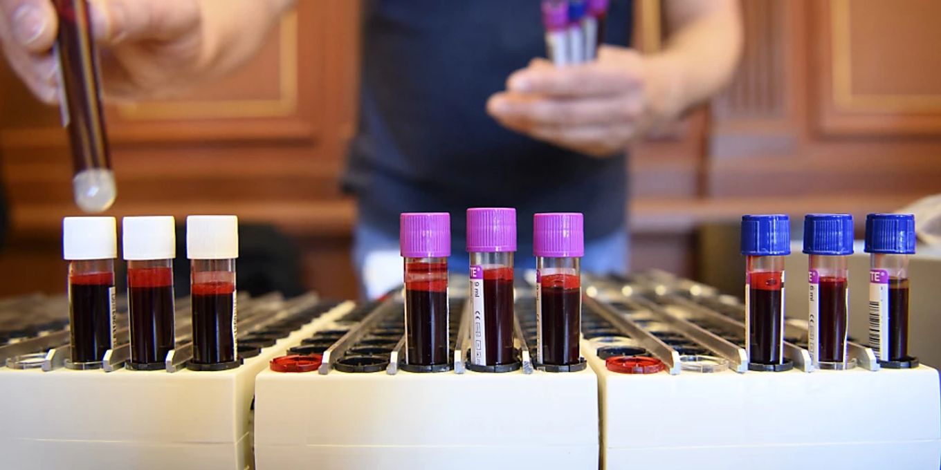 Blutspende-Organisation will Hürden für Schwule senken | Nau.ch