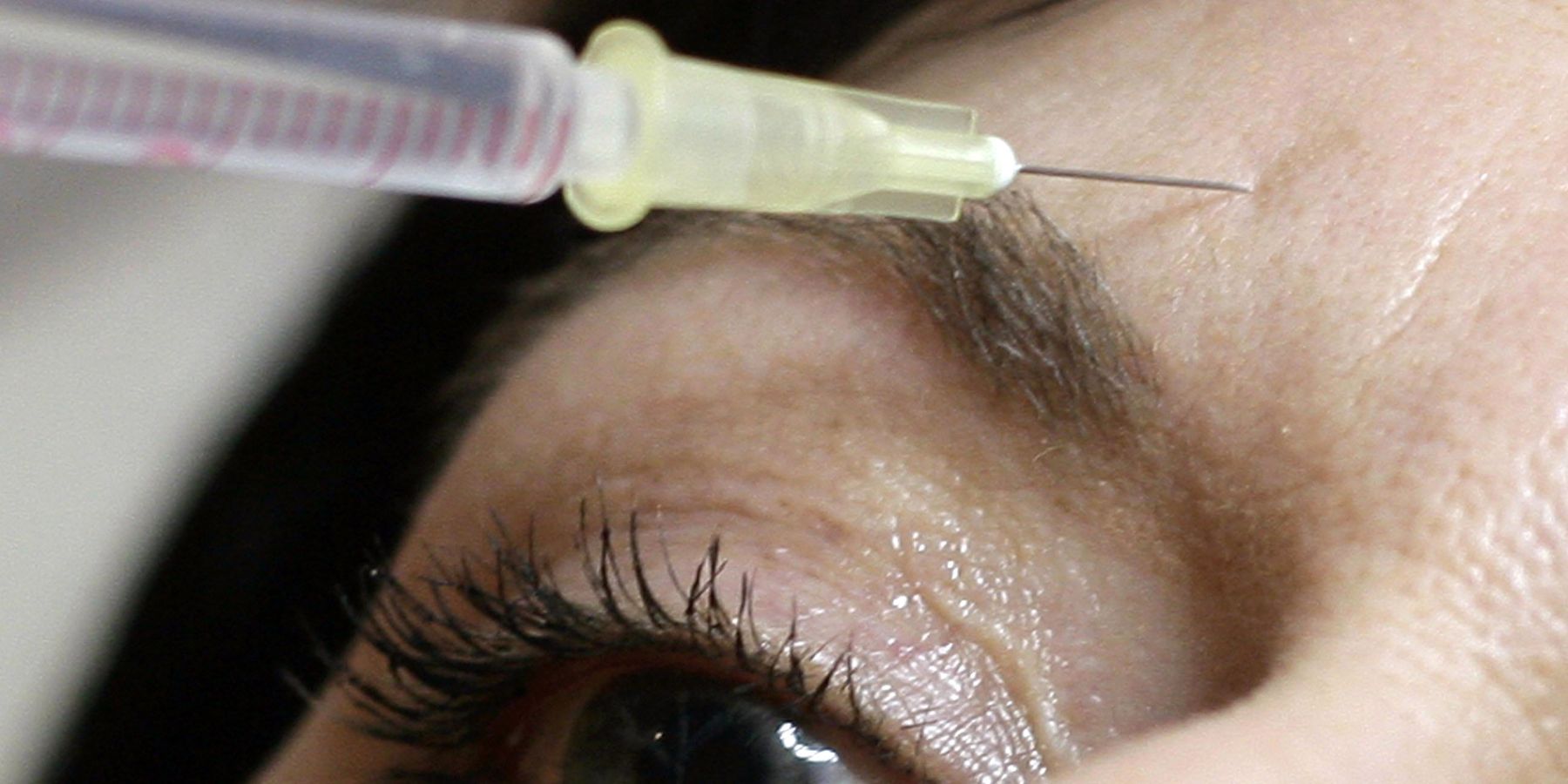 So ergaunert sich Juristin (51) Botox-Behandlung in Winterthur | Nau.ch