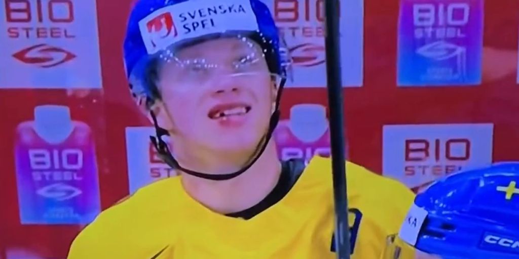 Eishockey-WM: Schweden-Star verliert Zahn – und sammelt ihn auf