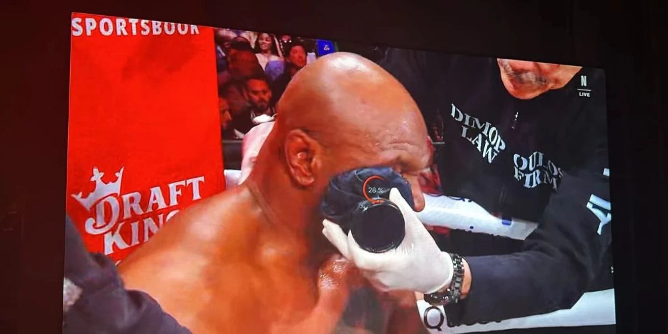 Mike Tyson: Darum gab es Netflix-Probleme | Nau.ch
