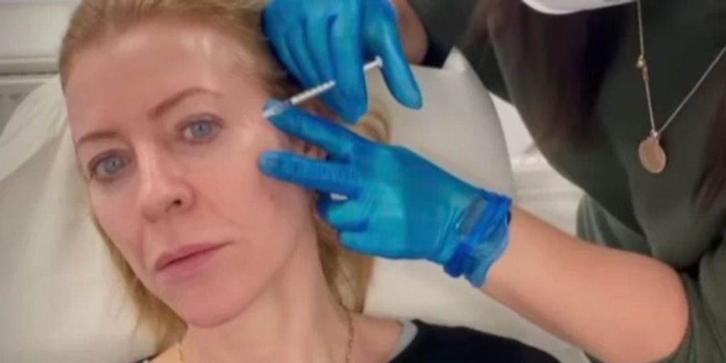 MRI von Britin zeigt, dass Face-Filler 20 Jahre im Gesicht bleiben