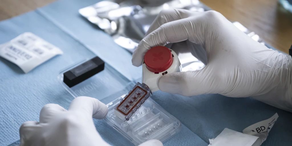 China-Doping-Affäre: Welt-Anti-Doping-Agentur sieht sich im Recht