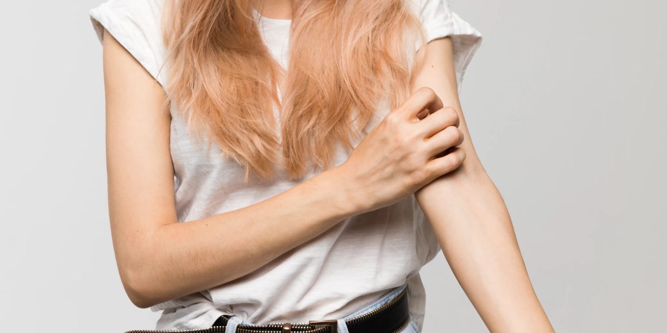 Was steckt hinter der Hautkrankheit Morbus Grover? | Nau Health