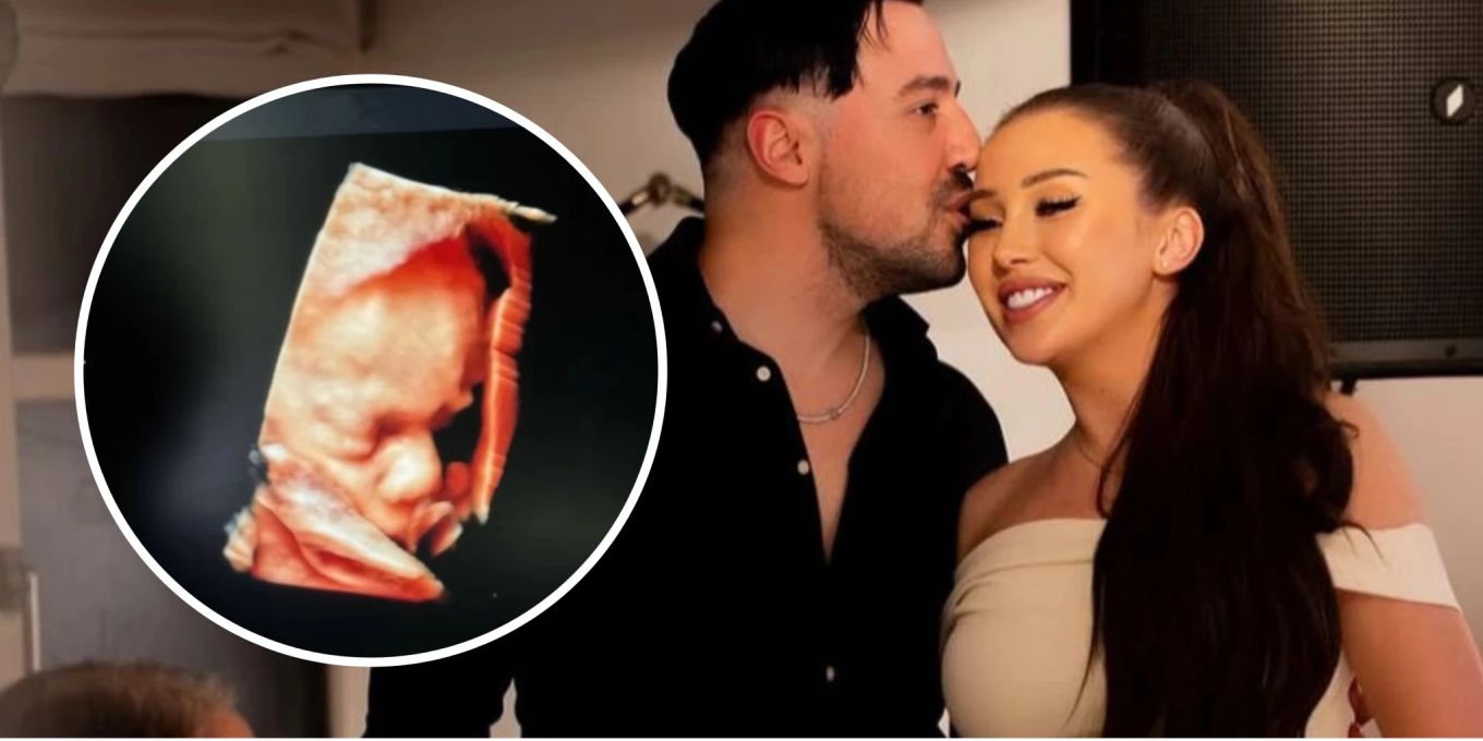 Zeki Bulgurcu zeigt Ultraschallbild – Baby kommt in zwei Monaten | Nau.ch